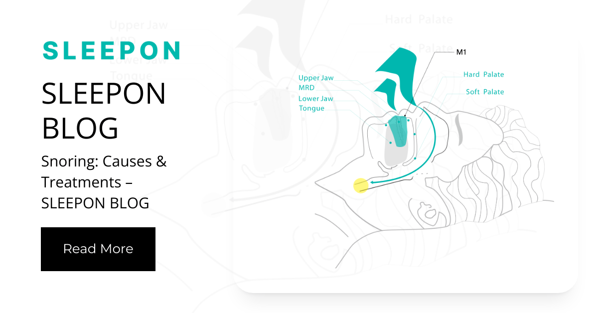 Snoring: Causes & Treatments - SLEEPON BLOG Snoring Treatment ...