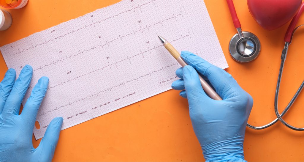 Understanding Resting Heart Rate SLEEPON