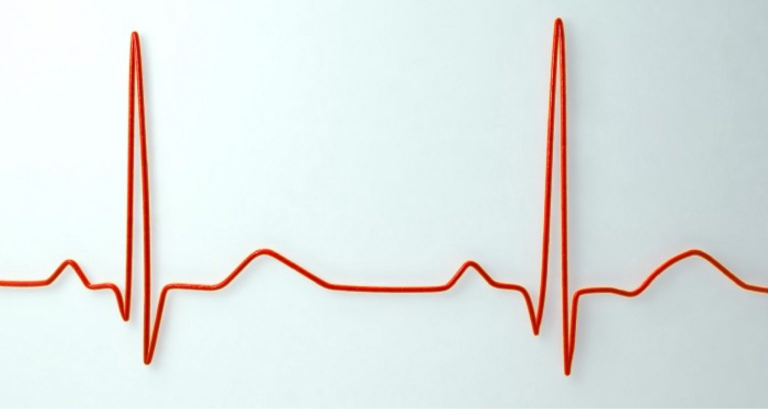 Understanding resting heart rate - SLEEPON