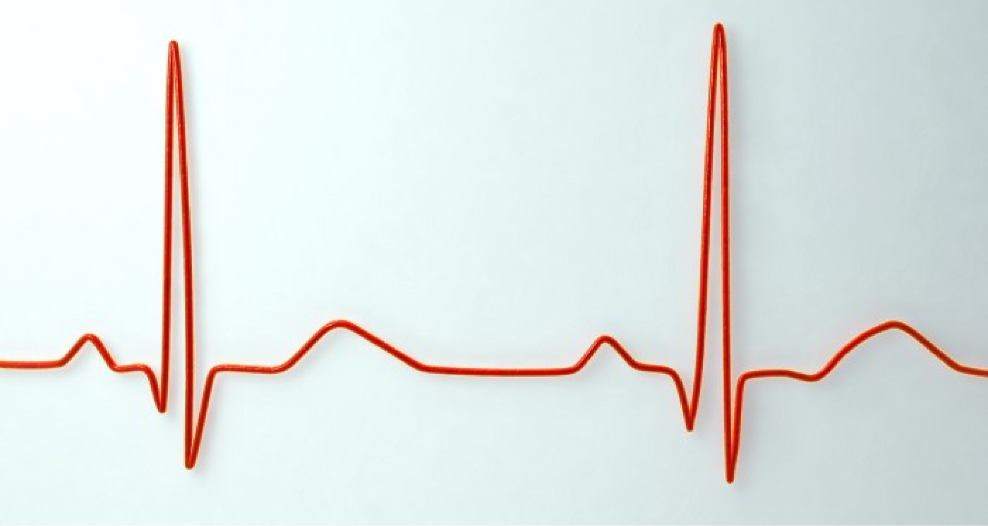 Understanding resting heart rate - SLEEPON